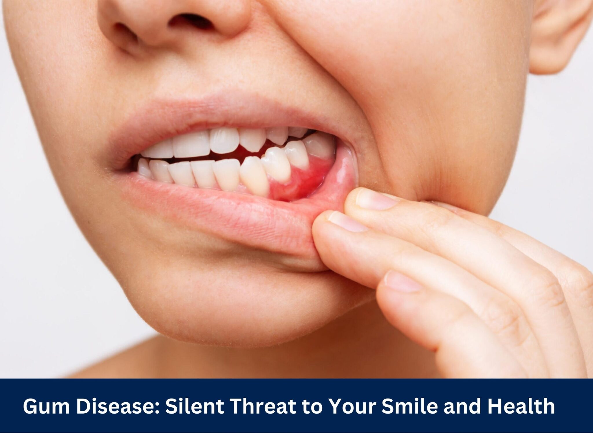 Gum Disease: Silent Threat to Your Smile and Health