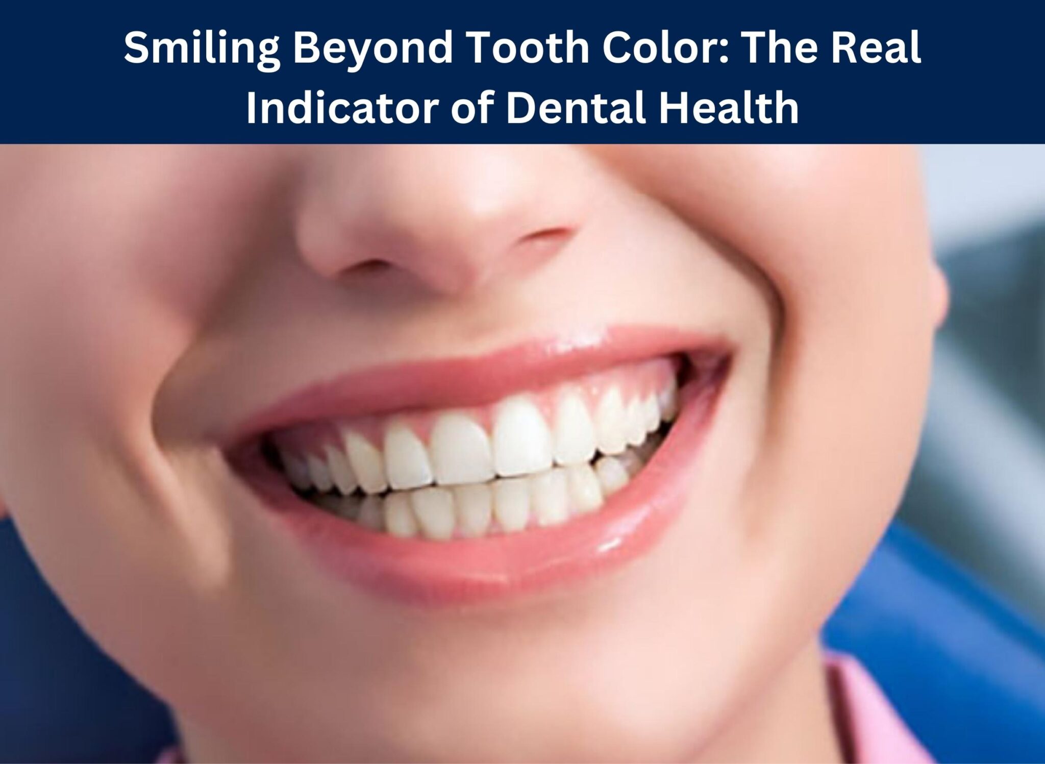 Smiling Beyond Tooth Color: The Real Indicator of Dental Health