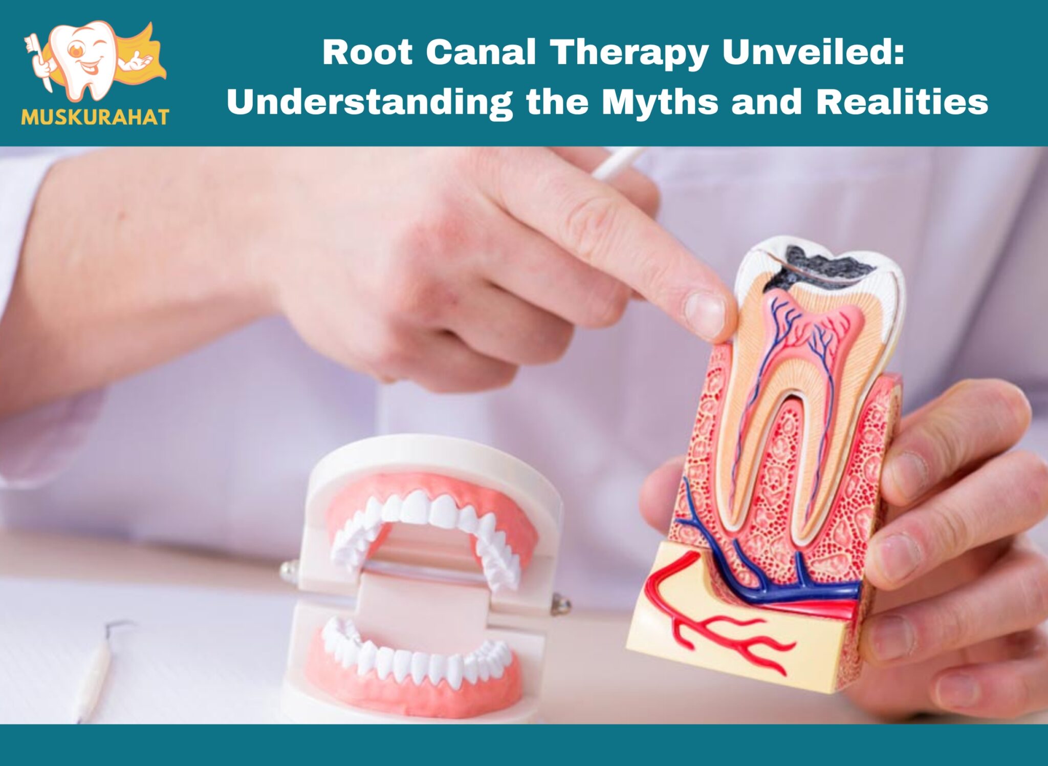 Root Canal Therapy Unveiled: Understanding the Myths and Realities